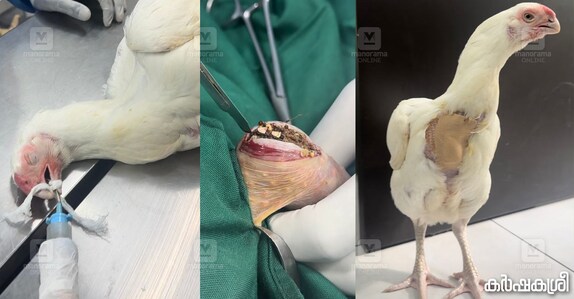 കൃത്രിമ മുട്ടകളുമായി ചികിത്സയ്ക്കു വന്നത് കോയമ്പത്തൂരിൽനിന്ന് ...