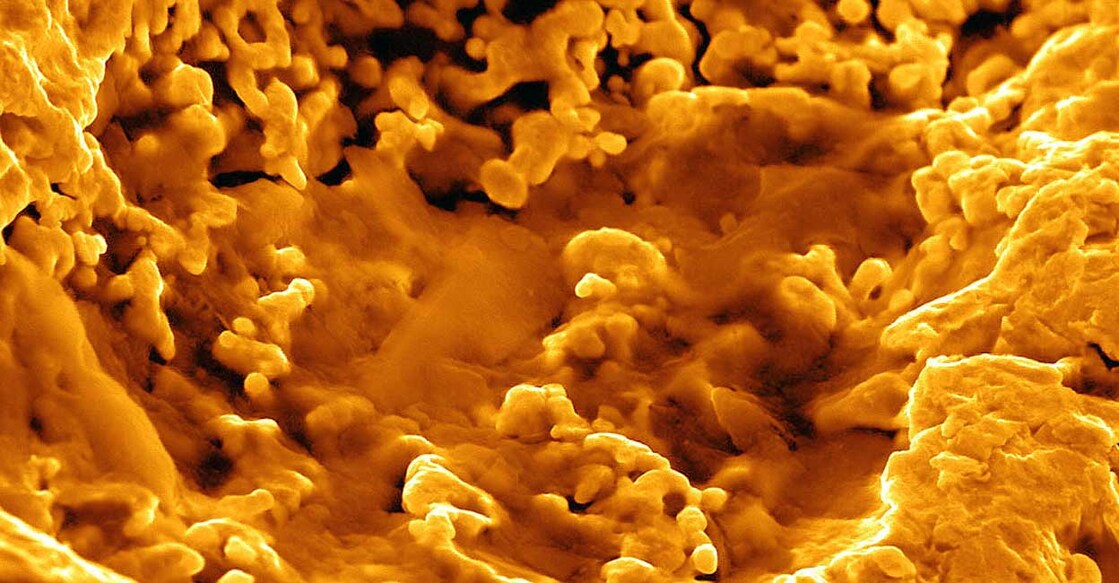 സ്വർണം വിസർജിക്കുന്ന ബാക്ടീരിയ: എന്താണ് കുപ്രിയവഡുസ് മെറ്റാലിഡുറൻസ് ...