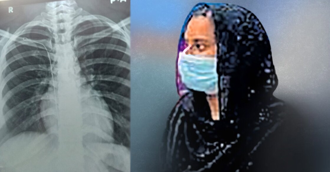 സുമയ്യയുടെ ചികിത്സ; കുടുങ്ങിയ ഗൈഡ്‌വയർ പുറത്തെടുക്കാൻ ശ്രമം നടത്തും ...