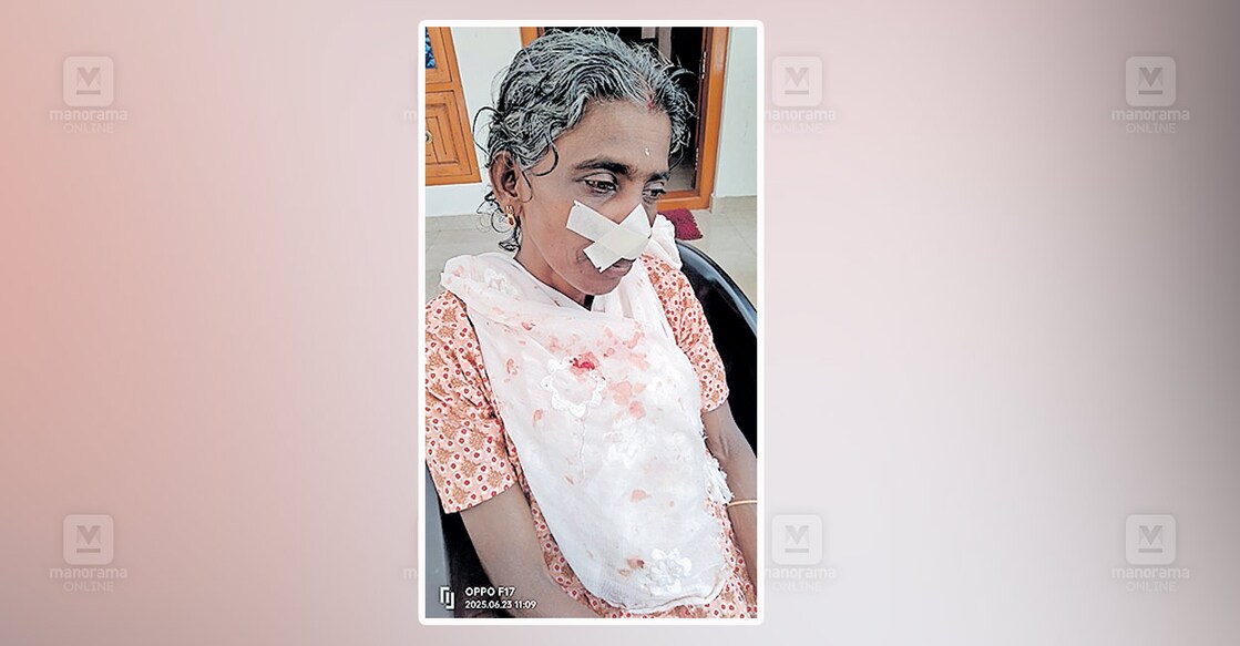 പരാതി പറഞ്ഞിട്ടും ആരും തിരിഞ്ഞു നോക്കിയില്ല; റോഡിലെ വെള്ളക്കെട്ടി ...