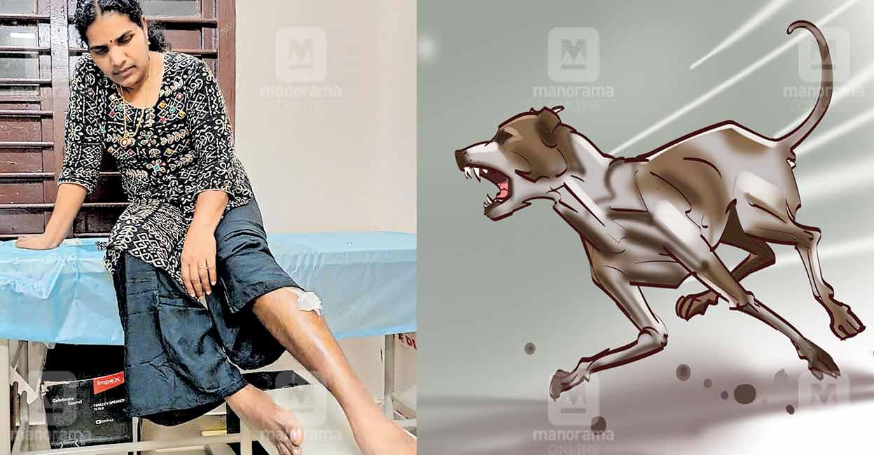 തെരുവുനായ വിളയാട്ടം തുടരുന്നു; ഒരാഴ്ചയ്ക്കിടെ നാലാമത്തെ ഡോക്ടർക്കാണ് ...