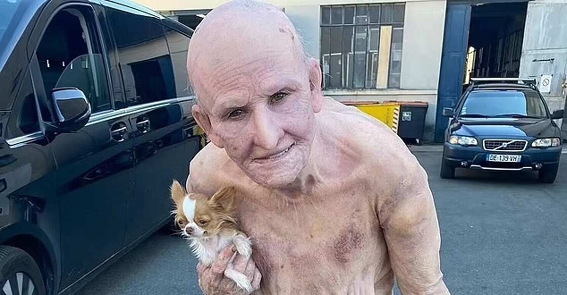 തലയിൽ മുടിയില്ല, ചുളിവുകൾ നിറഞ്ഞ മുഖം; ആരാധകരെ അതിശയിപ്പിച്ച ലുക്കുമായി ...