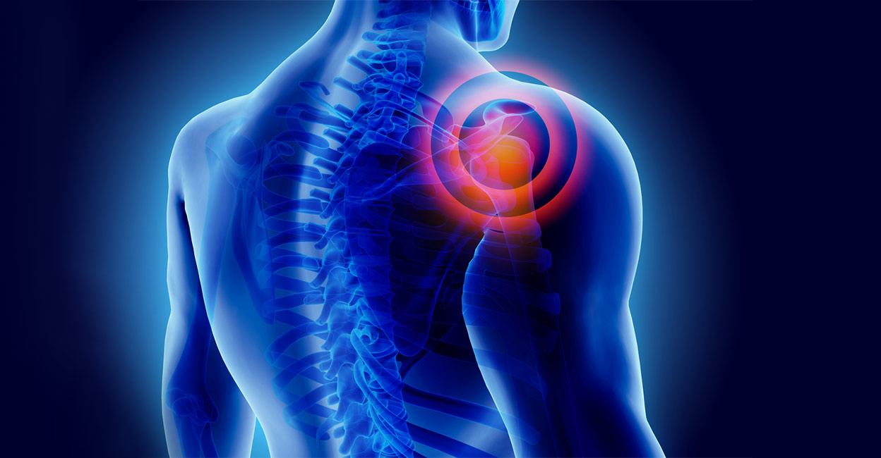 കാരിത്താസ് ആശുപത്രി അസ്ഥിരോഗ വിഭാഗം - Latarjet Shoulder Surgery ...