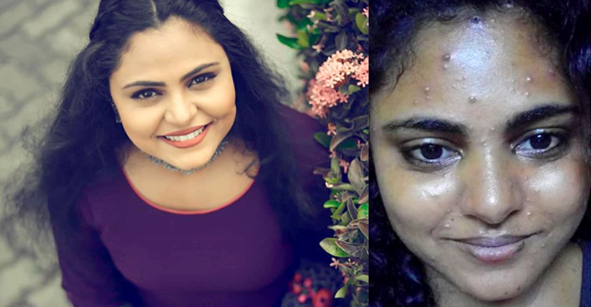 അയ്യോ വിൻസിക്ക് ഇതെന്തു പറ്റി