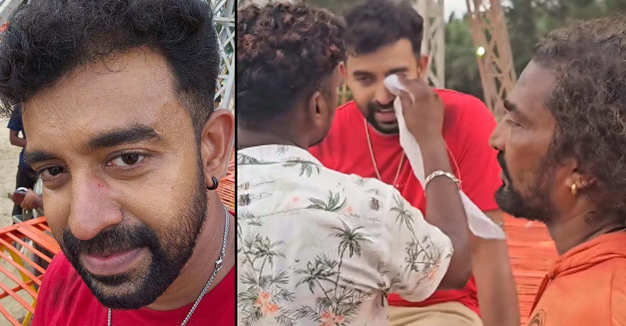 ‘ആശാന്റെ മൂക്കിടിച്ചു പരത്തി’; പരുക്ക് പറ്റിയ വിഡിയോയുമായി സിജു വിൽസണ് ...