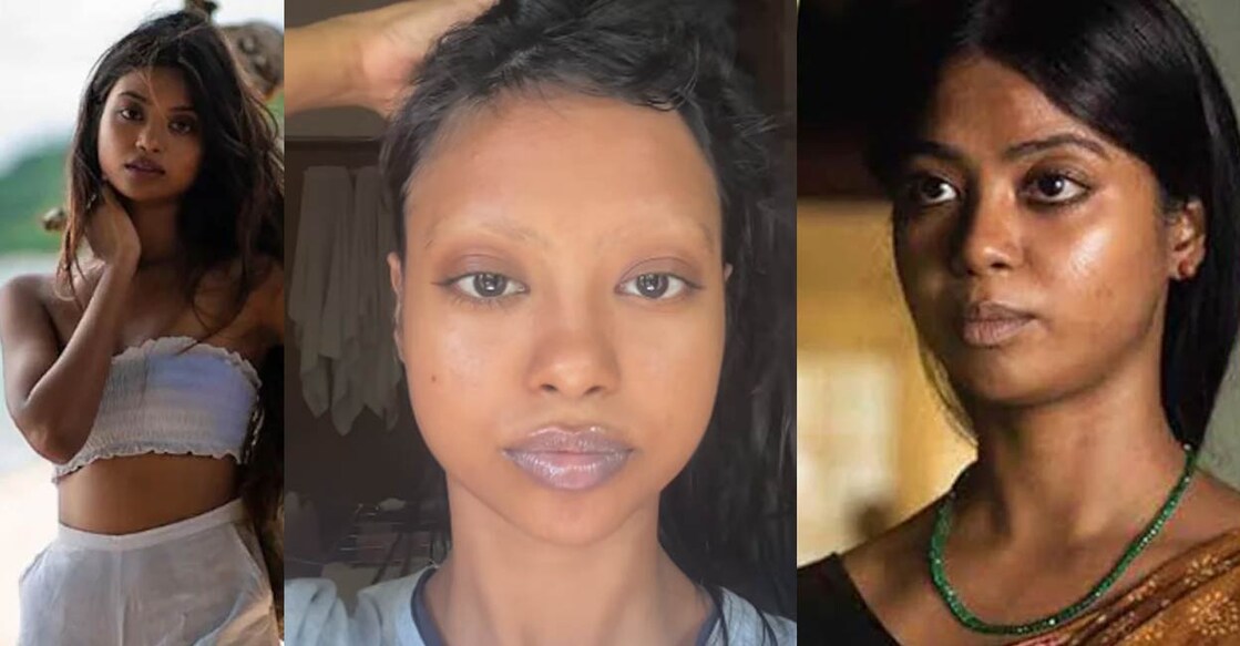 തലമുടി കൊഴിഞ്ഞു, പലതും നഷ്ടമായി; അപൂർവ രോഗം പറഞ്ഞ് നടി ഷോൺ റോമി | Shaun ...