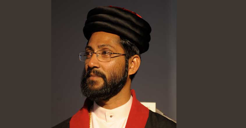 ബിഷപ്പ് ഡോ.മാർ യോഹന്നാൻ ഔസേപ്പിന്റെ നില മെച്ചപ്പെട്ടു | Mar yohannan ...