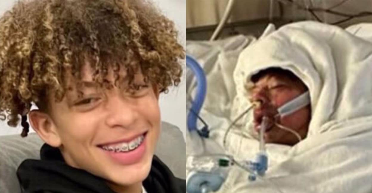 ടിക് ടോക് ചാലഞ്ച്: യുഎസിൽ 16 വയസ്സുകാരന് ഗുരുതരമായി പൊള്ളലേറ്റു ...