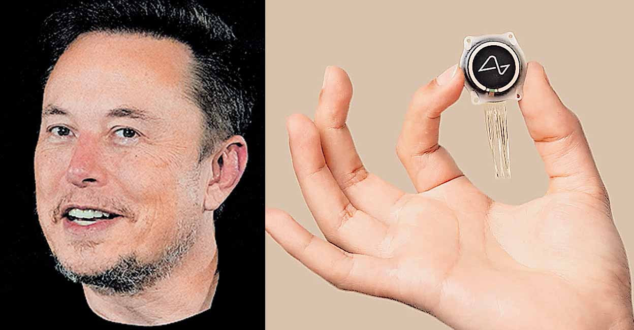 തലച്ചോറിൽ ചിപ്; ലോകം ടെലിപ്പതിയിലേക്ക്-Elon Musk | Neuralink ...