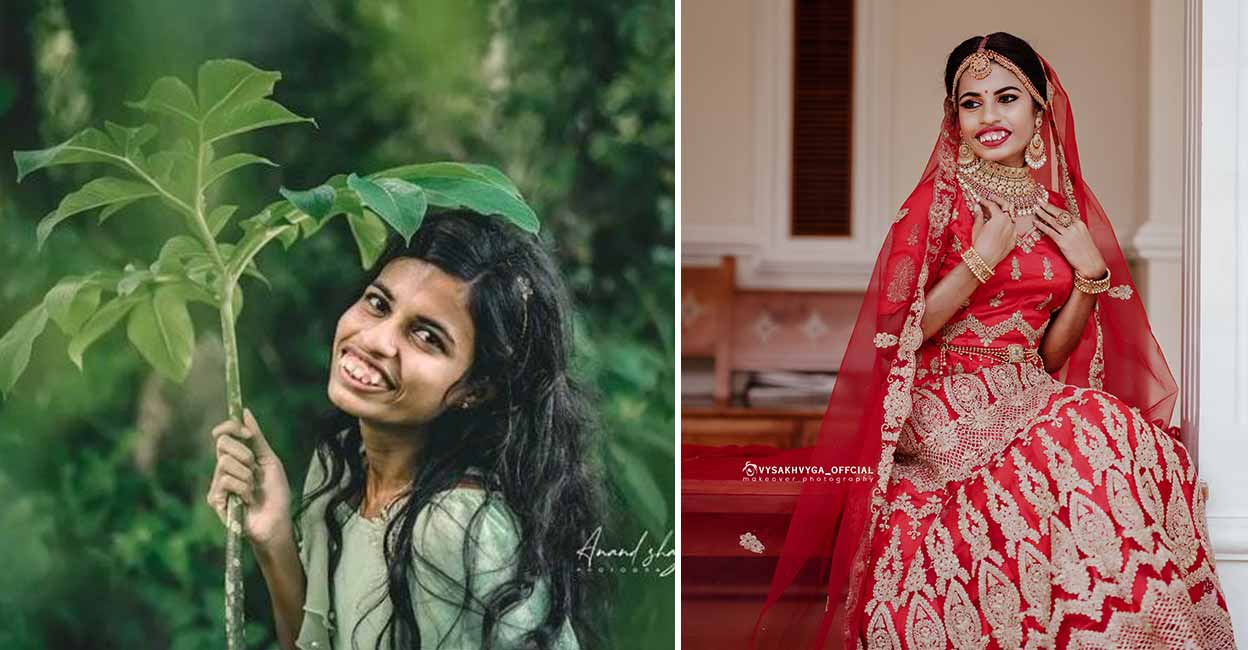 ഫോളോവേഴ്സിനെ കൂട്ടാനല്ല ഈ 'പല്ല് '; മോശം വാക്കുകൾ പറഞ്ഞവർ ഇന്ന് ...