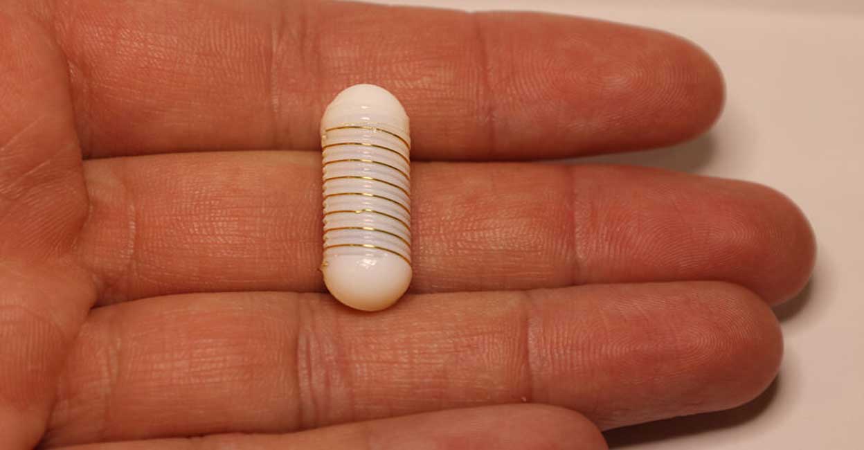 വയറിനകത്തെ ചില പ്രശ്നങ്ങൾ പരിഹരിക്കാൻ ‘ഗുളിക യന്ത്രം’