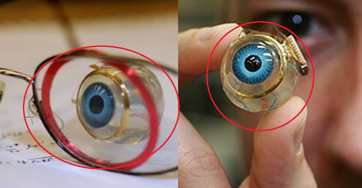 കണ്ണിനുള്ളിൽ ക്യാമറയും ചിപ്പും, ഇത് ഞെട്ടിക്കും കണ്ടെത്തൽ, അന്ധൻമാർക്ക് ...