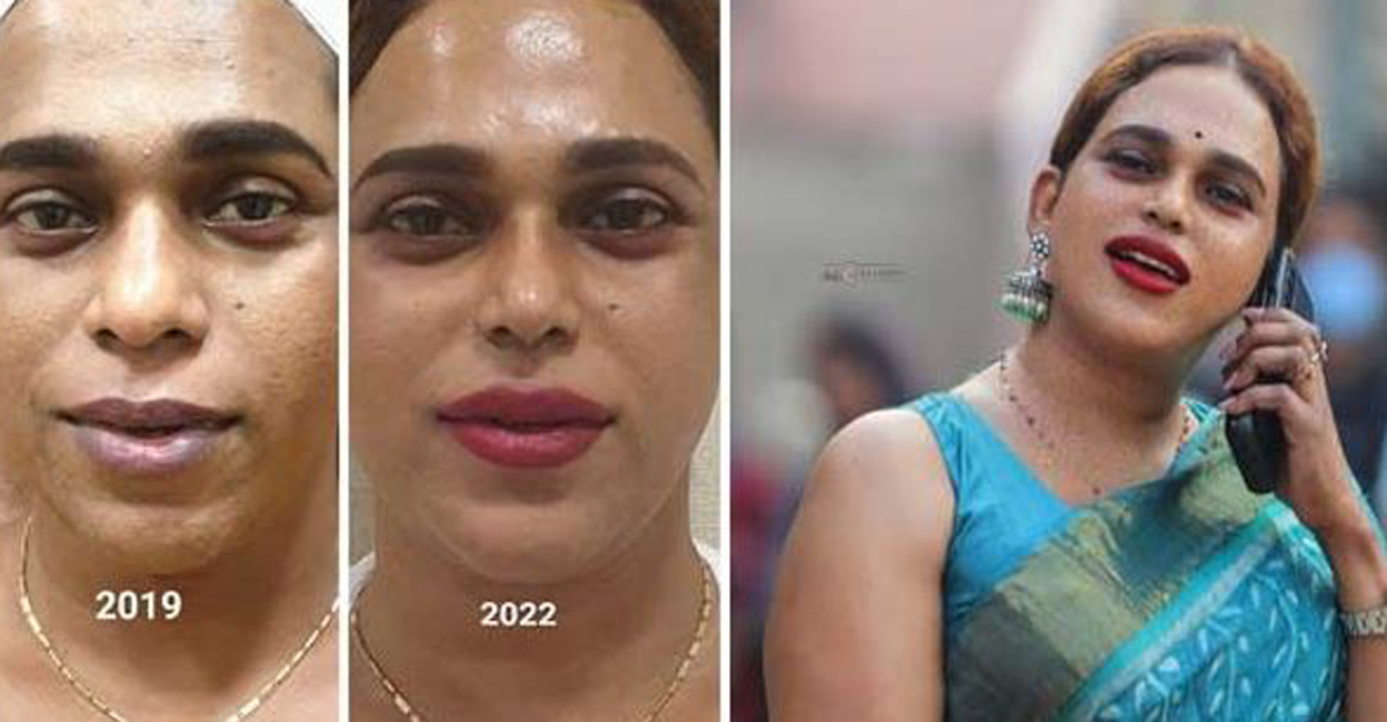 മറ്റൊന്നും എന്നെ അലട്ടിയില്ല|women|viral news|viral post|renju renjimar ...